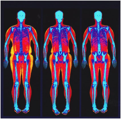 Are you compromising Quality with a DEXA Scan Van vs. Traditional Offi ...